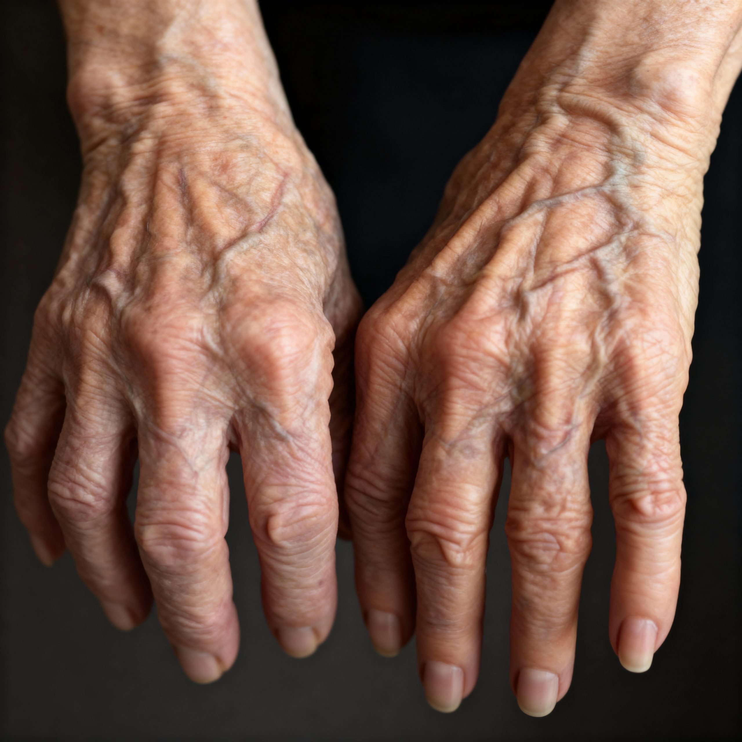 Visible Veins Explained: Normal Causes, Health Risks, and When to Worry ...