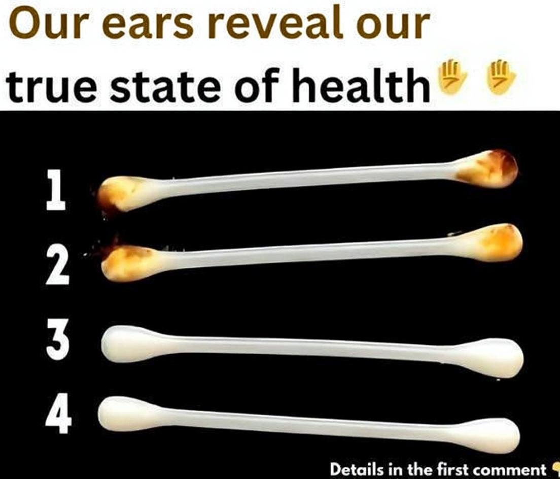 What Your Ears Secretly Say About Your Health – BeInspireDaily